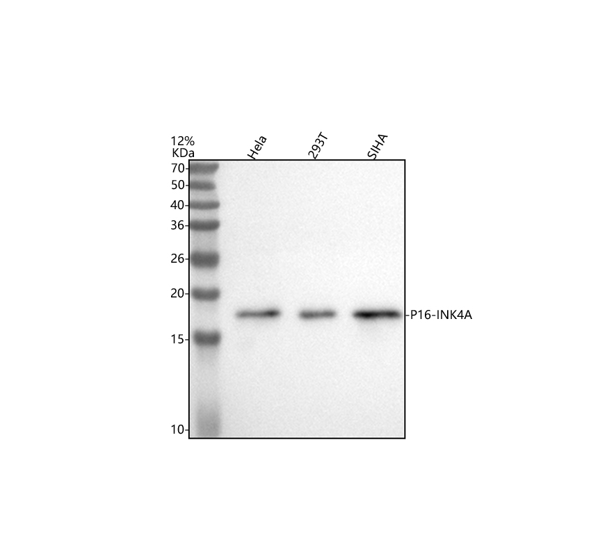 博士德生物 BOSTER Biological Technology co.ltd | 1993-2025