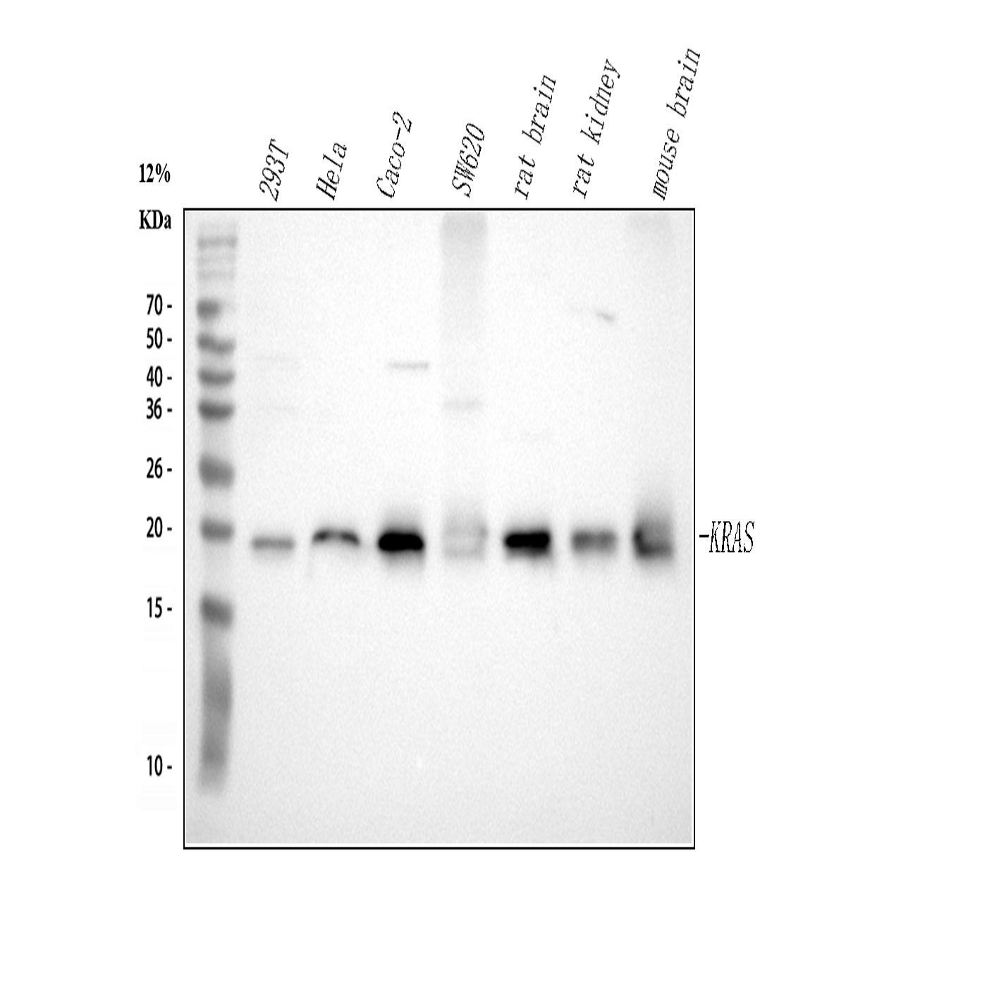 博士德生物 BOSTER Biological Technology co.ltd | 1993-2025