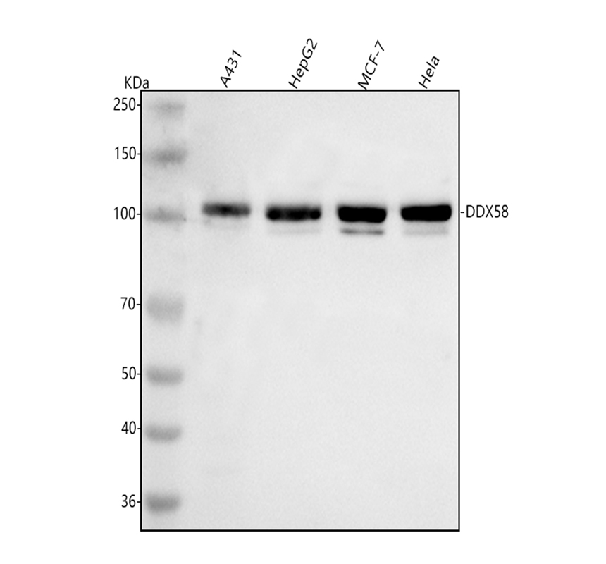 博士德生物 BOSTER Biological Technology co.ltd | 1993-2025