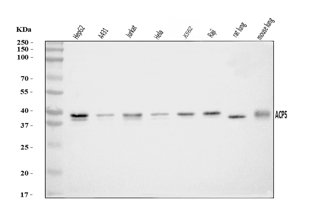 博士德生物 BOSTER Biological Technology co.ltd | 1993-2025