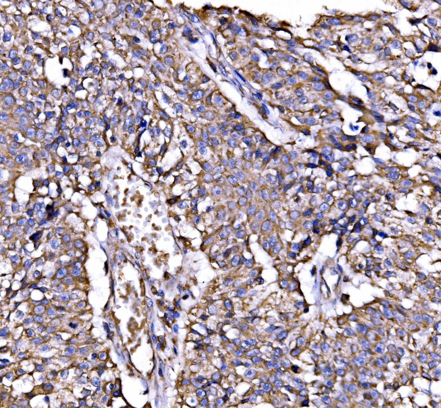 博士德生物 BOSTER Biological Technology co.ltd | 1993-2025