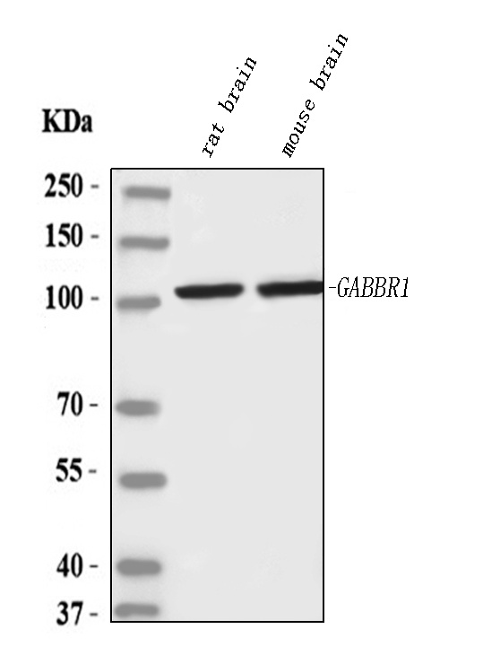 博士德生物 BOSTER Biological Technology co.ltd | 1993-2025