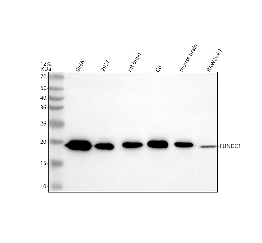 博士德生物 BOSTER Biological Technology co.ltd | 1993-2025