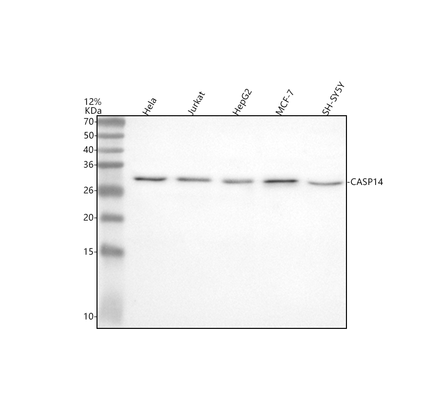 博士德生物 BOSTER Biological Technology co.ltd | 1993-2025