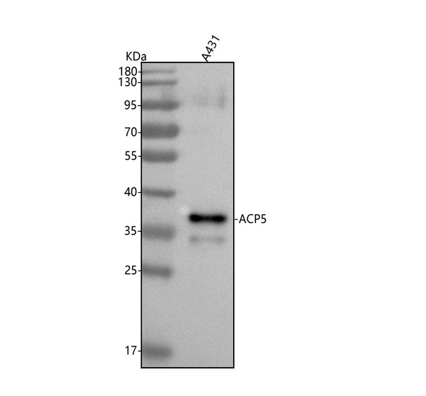 博士德生物 BOSTER Biological Technology co.ltd | 1993-2025