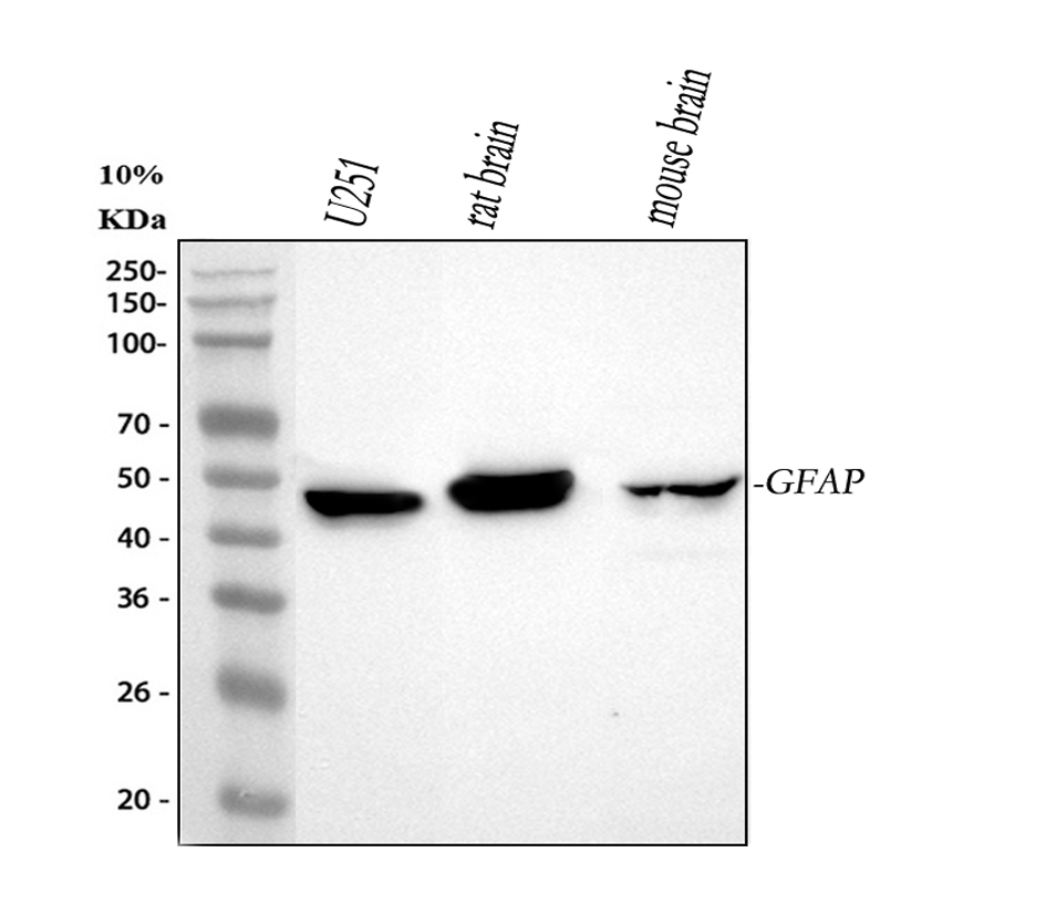 博士德生物 BOSTER Biological Technology co.ltd | 1993-2025