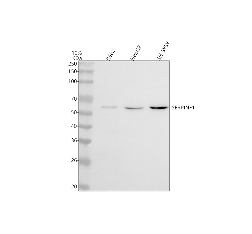 博士德生物 BOSTER Biological Technology co.ltd | 1993-2025