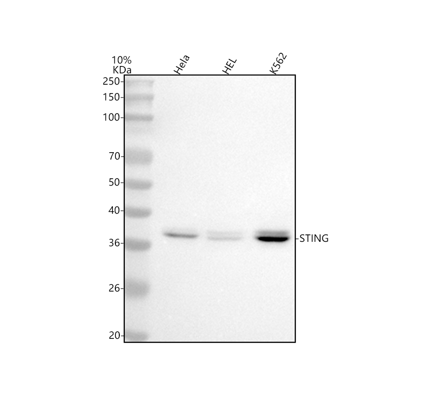 博士德生物 BOSTER Biological Technology co.ltd | 1993-2025